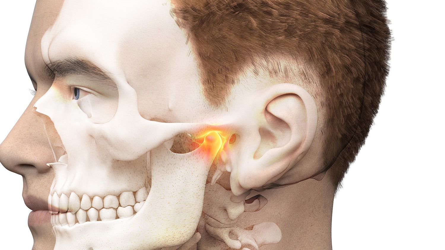 TMJ Disorder: Causes, Symptoms & The Best Treatment in Dubai - ledente